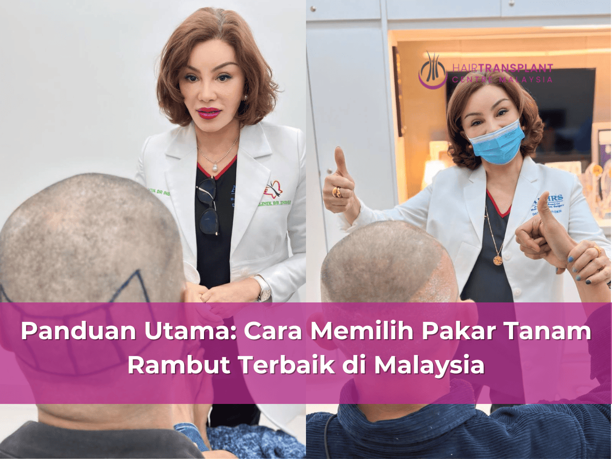 Panduan Utama: Cara Memilih Pakar Tanam Rambut Malaysia